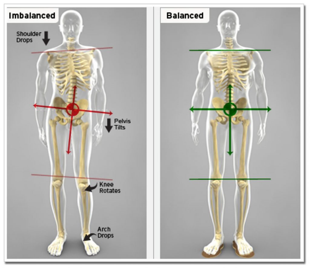 Short Leg - The Podiatry Experts